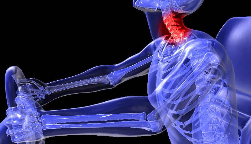 car-accidents-5-things-you-should-know-guelph-physiotherapy-guelph